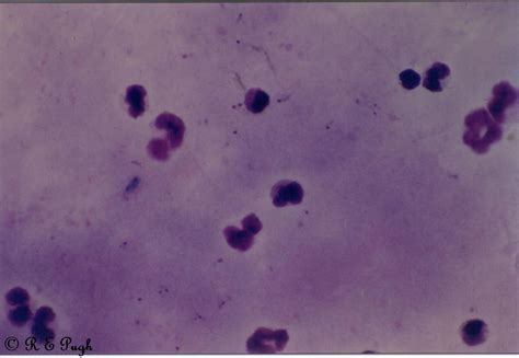 Plasmodium Slide Labeled