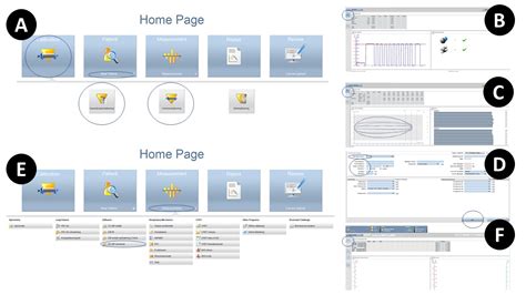 Video Author Spotlight Integrating Alveolar Capillary Reserve Measurements In Exercise
