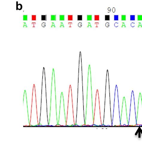 An Electropherogram Of Str Genotypes From A Suspected Siha Cell Line A Download Scientific
