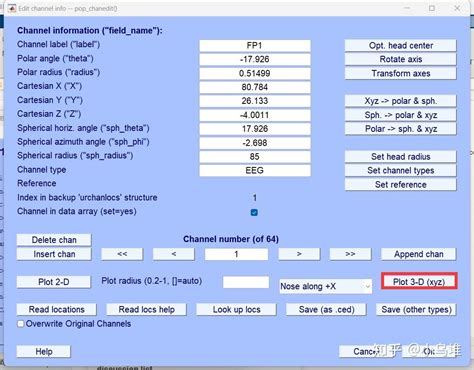Matlab医学信号处理1 (eeglab保姆级别教程) 知乎 Matlab医学信号处理1 (eeglab保姆级别教程) 知乎