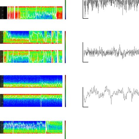 Screen Captures Of Color Density Spectral Array Cdsa In The Intensive