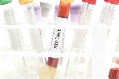 Accurate Std Testing