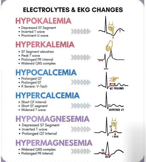 Dr Mudasir Rana On Linkedin Hypokalemia Hyperkalemia Hypocalcemia