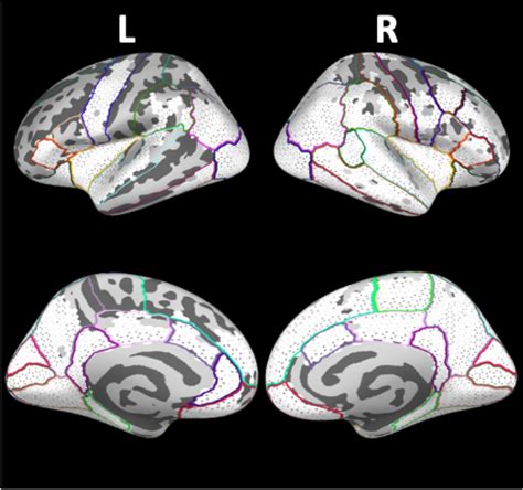 Spatial Maps Of All Anatomical Regions With Combined Clusters Of Download Scientific Diagram