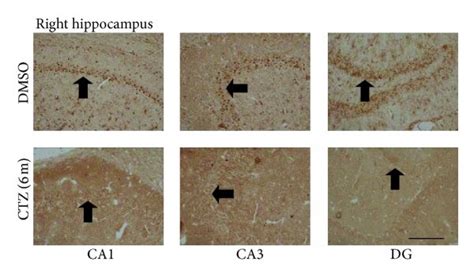Decreased Bdnf Staining In Hippocampus Of Recurrent Seizure Rats 6 Download Scientific Diagram