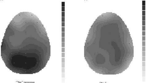 Topography Maps Of Erps Showing Scalp Distribution Of The Di¡erence