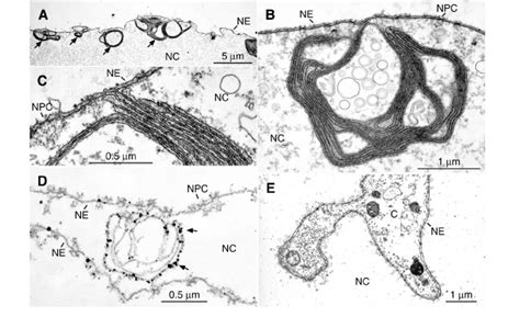 Electron Microscopy Of Lamin Induced Intranuclear Membrane Structures