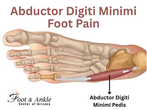 Types Of Bunion Surgery A Comprehensive Guide