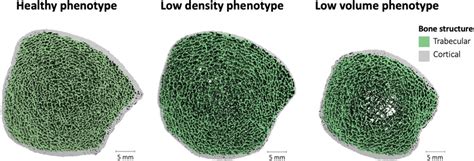 Three Dimensional Reconstruction Of Hr Pqct Scans At The Distal Tibia Download Scientific