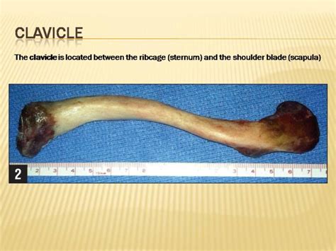 Attribution Of Sex Through Thorax Ribs Sternum Pelvis PPT Forensics Digest