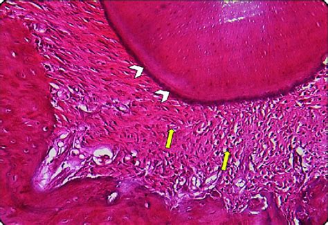 A Photomicrograph Of Control Group Showing Apical Group Of Periodontal Download Scientific