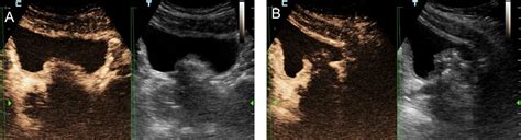 Ultrasound Journal 14 Basic And Advanced Ultrasonographic Techniques For Evaluation Of