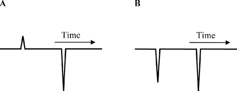 Figure 1 From Determination Of Binding Constants By Affinity Capillary