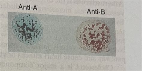A P Lab 29 Flashcards Quizlet