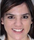 Tips To Get Rid Of Zits