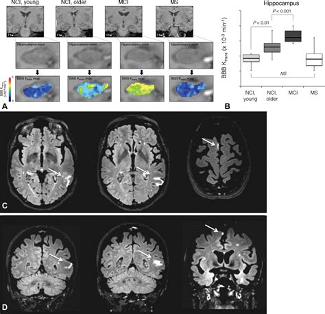 Current Concepts in Intracranial Interstitial Fluid Transport and the ...
