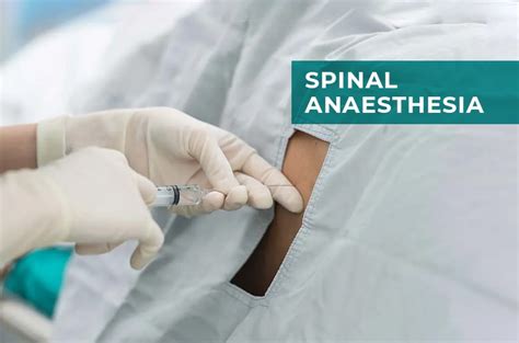 Spinal Anesthesia What Is It Indications And Contraindications