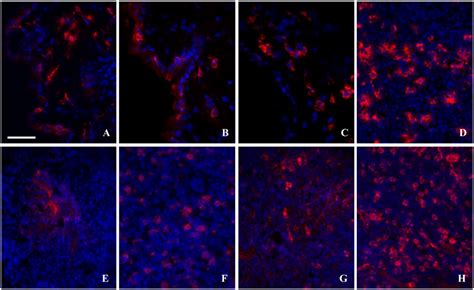 Revisiting Fixation And Embedding Techniques For Optimal Detection Of Dendritic Cell Subsets In