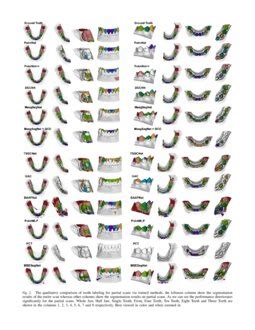 A Critical Analysis Of The Limitation Of Deep Learning Based D Dental Mesh Segmentation Methods