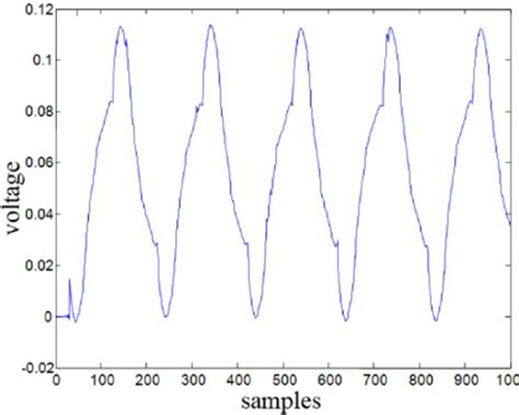 Output Of Pulse Oximeter Depicting In Matlab For Three Different
