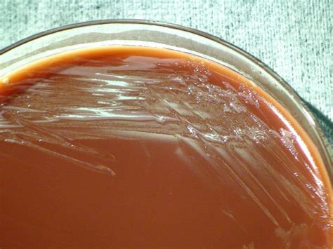 Free Picture Morphology Brucella Laboratory Bacteria Chocolate Agar
