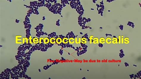 Enterococcus Faecalis Gram Stain