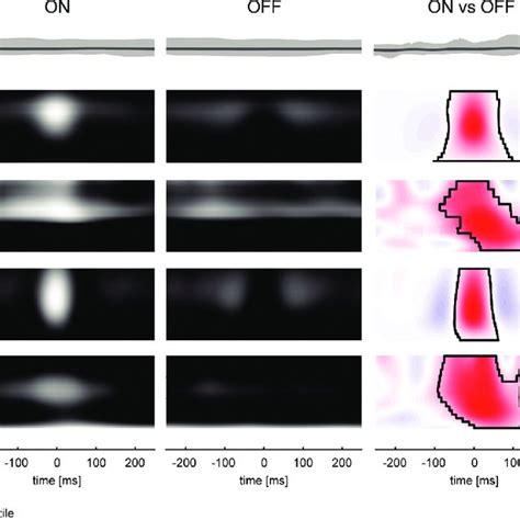 neural activity during b bursting events present in the eeg on and off
