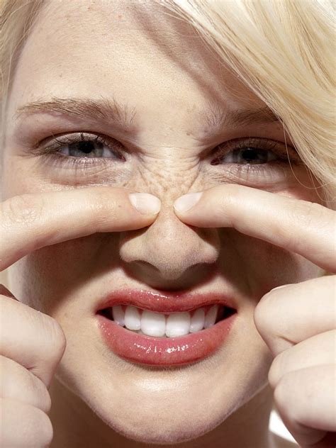 Pimples On The Nose Causes And Treatments SmuGG BuGG