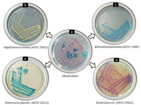 Enterococcus Faecalis Streak Plate