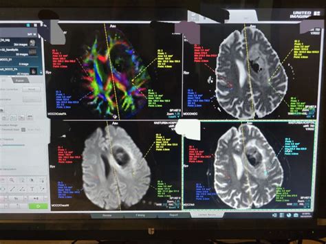 Impressive Works Being Done Here At Kasturba Medical Centre Manipal