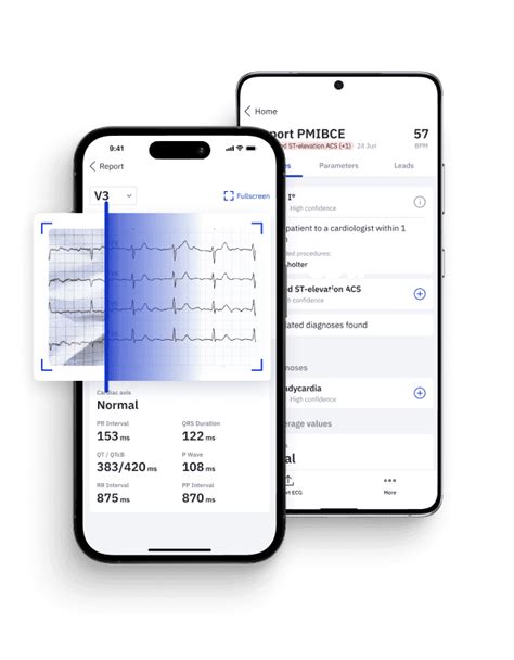 What Is Occlusion Myocardial Infarction Omi