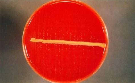 Staph Streak Test Haemophilus Will Satellite Around A Streak Of S