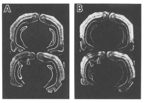 Egr3 And Zif268 Mrnas Are Regulated By Afferent Visual Activity Adult Download Scientific