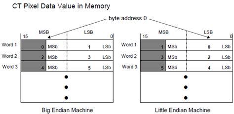 dicom is easy chapter 12 pixel data