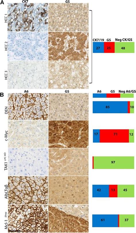 Characterization Of Hcc Mouse Models Towards An Etiology Oriented