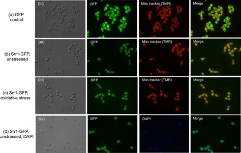 Subcellular Localization Of Srr1 Gfp All Images Have Similar Contrast