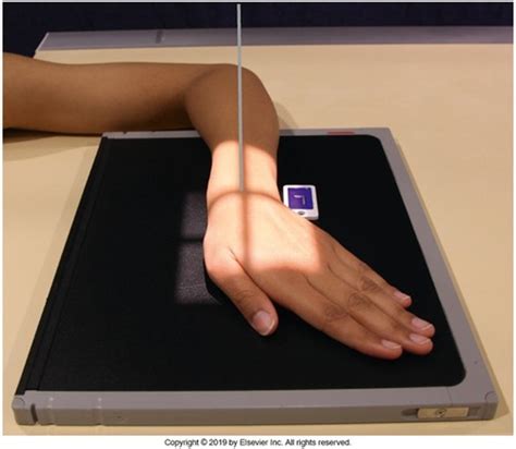 Scaphoid Flashcards Quizlet Scaphoid Flashcards Quizlet