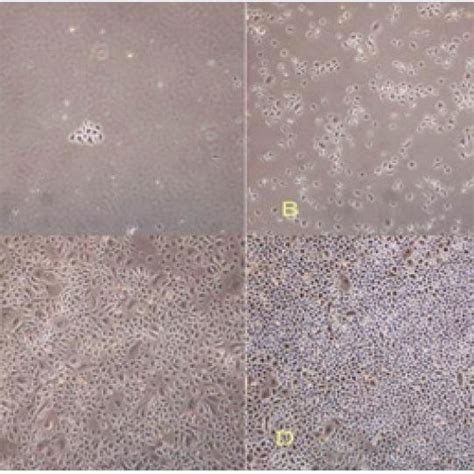The Effect Of Seeding Density On Cell Growth Cells Were Seeded At