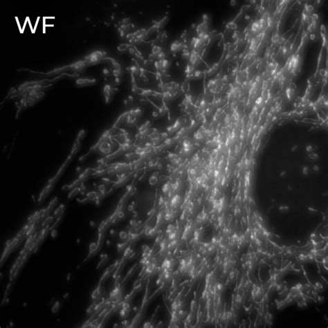Breaking The Diffraction Limit Discovering Cellular Organelles With Structured Illumination