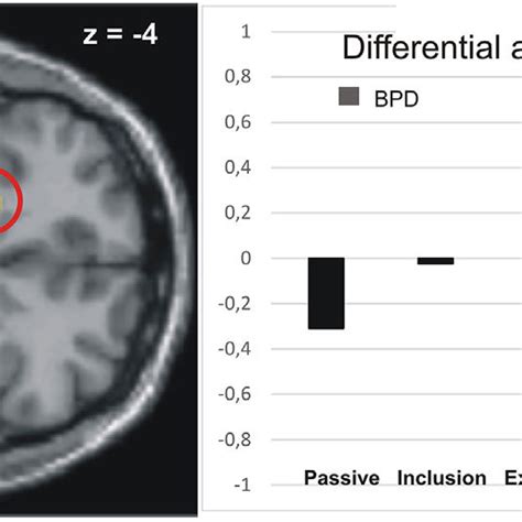 Activation In The Dorsolateral Prefrontal Cortex Dlpfc And Download Scientific Diagram