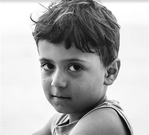 Blefaritis En Niños