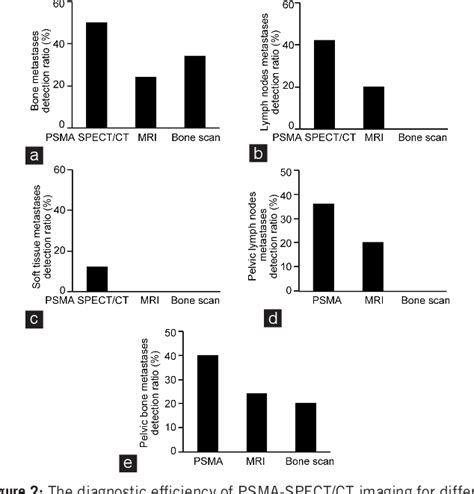 Figure 2 From Evaluation Of 99mtc Labeled Psma Spect Ct Imaging In Prostate Cancer Patients Who