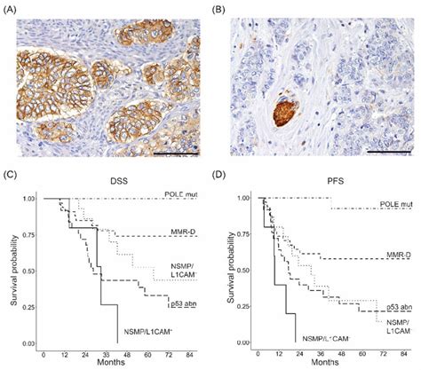 Ihc Staining For L1cam In Nsmp Ec Samples Of The Brescia Cohort Two Download Scientific