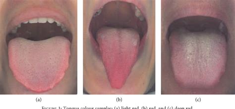 Figure 1 From A Fast Svm Based Tongues Colour Classification Aided By
