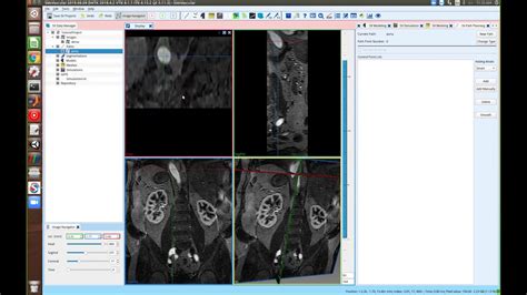 Simvascular Tutorial 2 Creating Centerline Paths Youtube