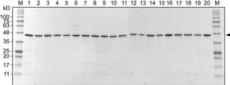 Sds Page Analysis Of Csce Variants Purified By Ni Affinity