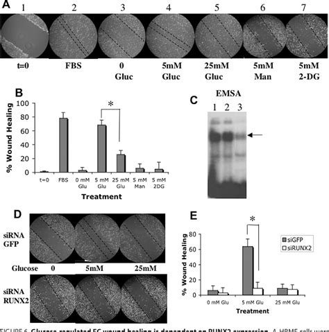 Figure 6 From Hyperglycemia Regulates Runx2 Activation And Cellular