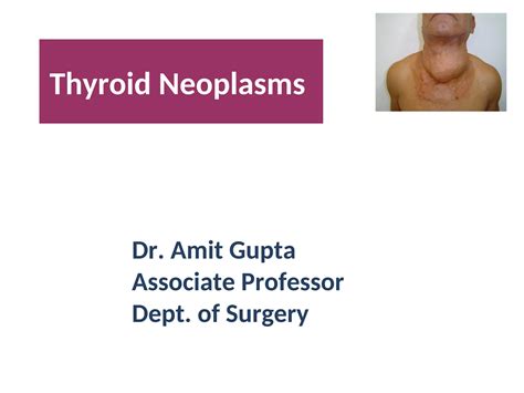 Classification Of Thyroid Tumors A Standardized Diagnostic Approach Ppt