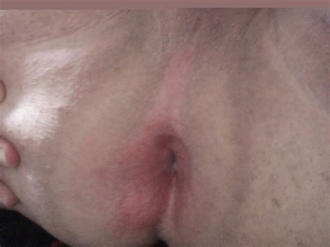 عکس سوراخمو فقط سن بالا ها ببینن