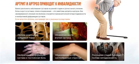 Артрейд для суставов — реальные отзывы купить в аптеке по лучшей цене развод или нет